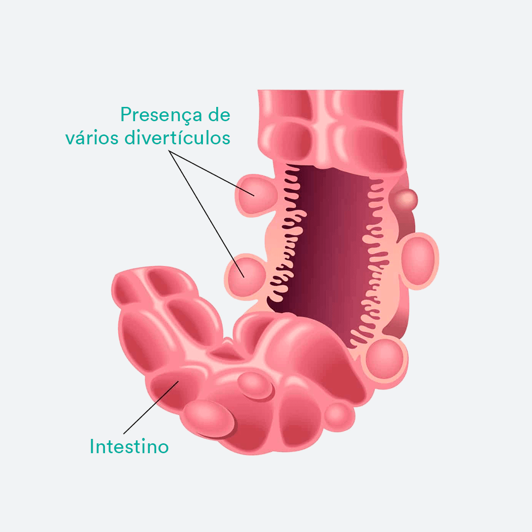 Coloproctologia - Diego Yuji Ito